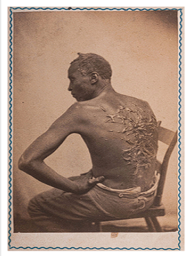 The First Viral Photograph was of a Enslaved Person’s Whipped Back ...
